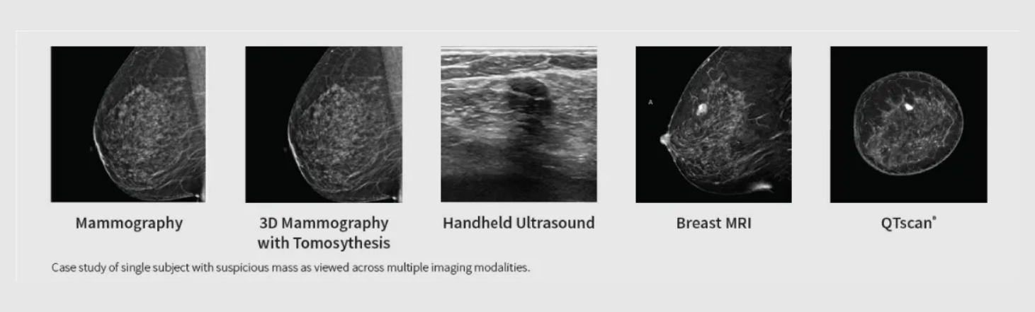 Qlarity Best Imaging – Every Woman Deserves Clarity and Comfort